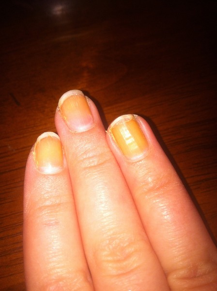 Gross Yellow Nails! | Beautylish