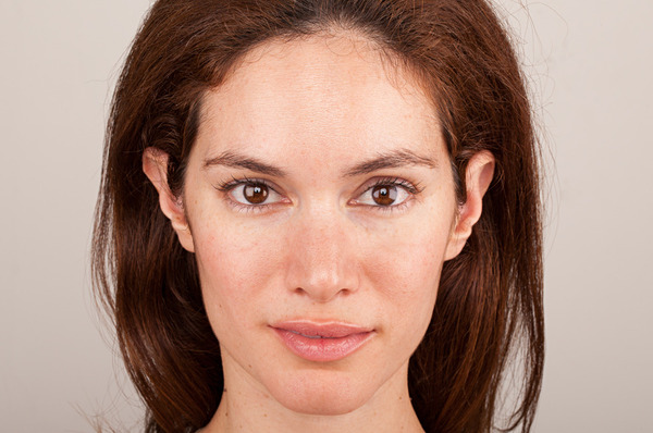 How to Deal With Face Redness | Beautylish