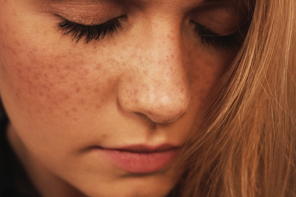 Freckles | Sam K.'s Photo | Beautylish