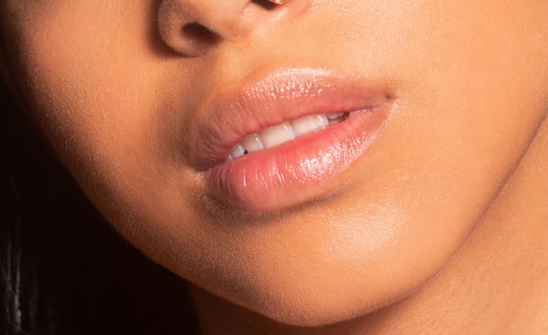 Can Hyaluronic Acid and Vaseline Replace Lip Fillers? | Beautylish