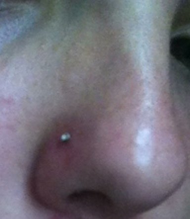 Tiny red bump on my new piercing? | Beautylish