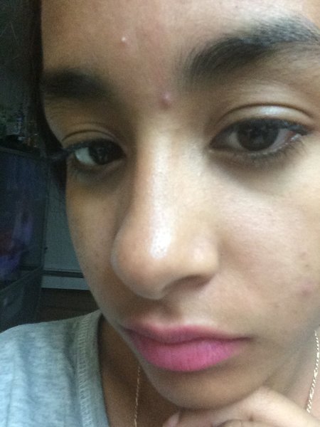 Get rid of pimple? | Beautylish