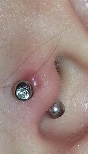 My Tragus Is Infected. | Beautylish