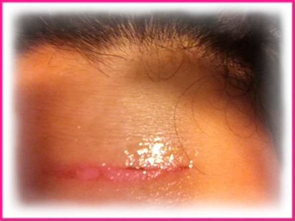 Cover-Up for a Burn Scab? | Beautylish