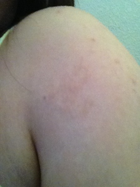 Birthmark/Beauty Mark, Embrace It :) | Beautylish