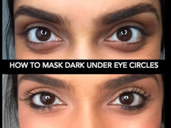 Fine lines under eyes. | Beautylish