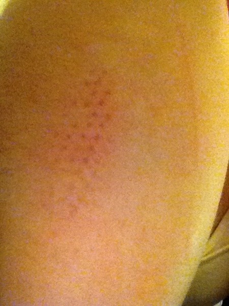 What are these strange dots on arm :( help. | Beautylish