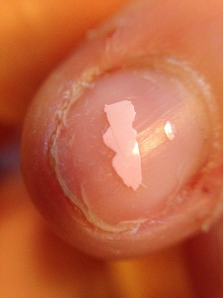 Really gross nails 😭 | Beautylish