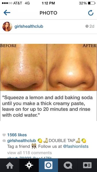 Weird bumps on my nose... What are they? | Beautylish