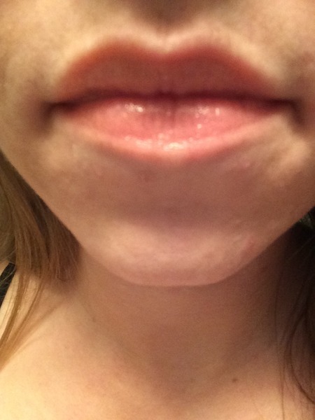 Weird line around lips? | Beautylish