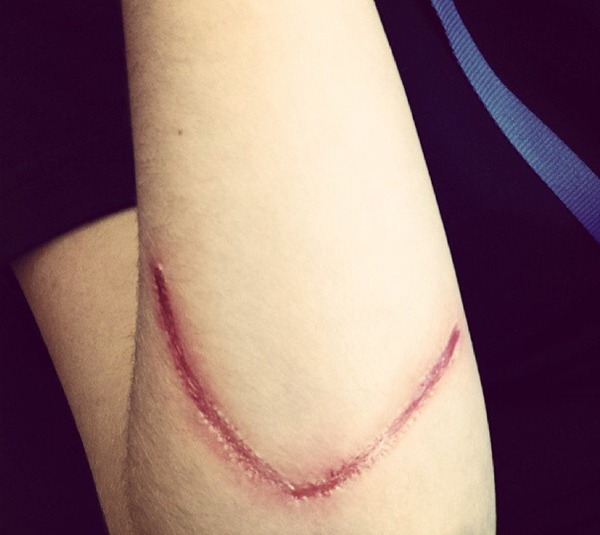 Theatrical & Special Effects Scars | Poppy R.'s (poppyrmakeup) Photo ...