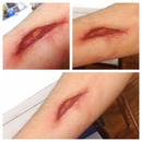 Scar | Sarah C.'s Photo | Beautylish