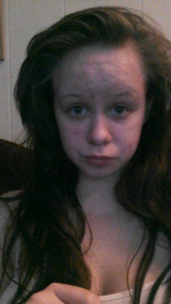 World's Biggest Forehead (repost 3) | Beautylish